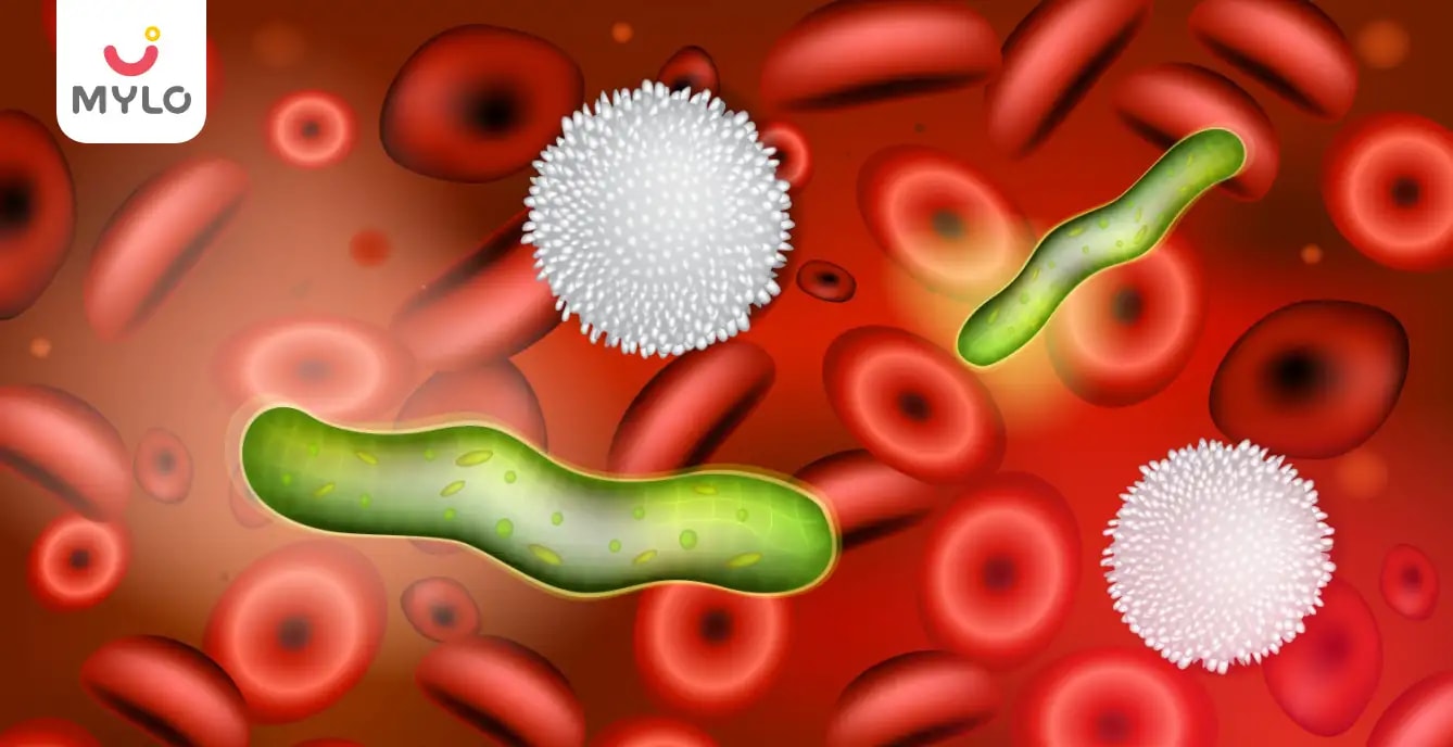 Puerperal Sepsis: Symptoms, Causes, Risks & Treatment |MyloFamily