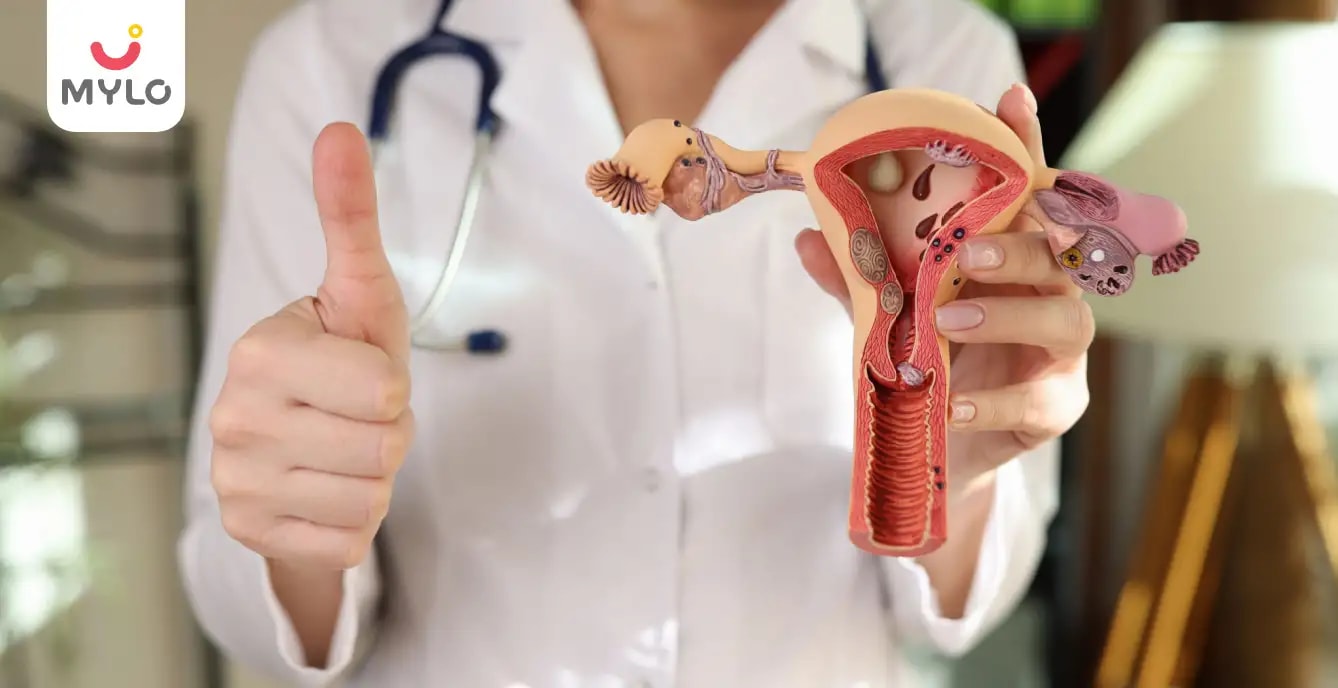 Rectocele: Causes, Symptoms & Treatment | MyloFamily